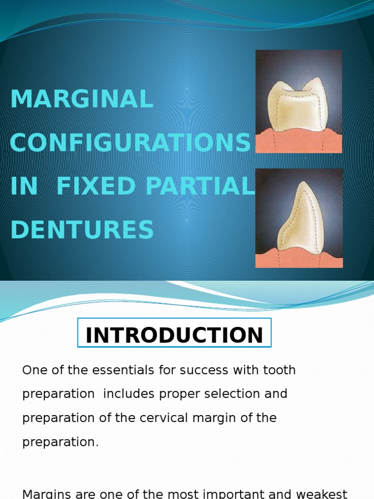 Marginal Configurations in Fpd | Mouth | Health Sciences