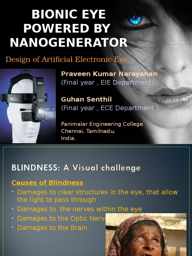 Bionic Eye Powered by NG | PDF | Retina | Vision