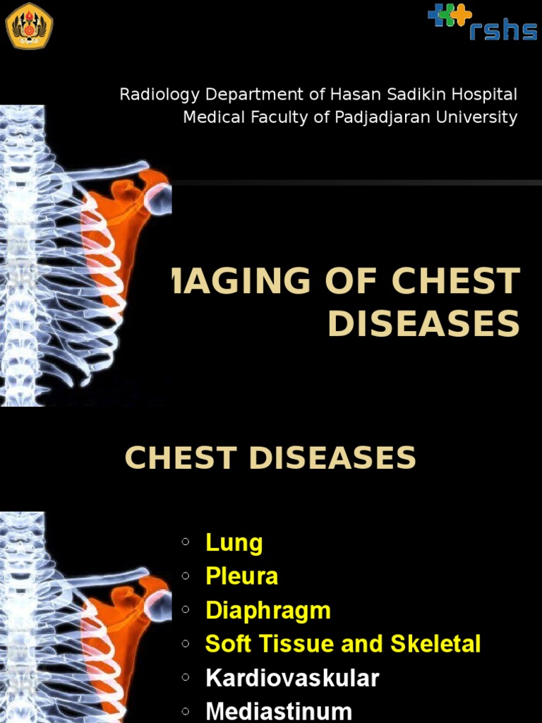 Imaging of Chest Diseases | PDF | Lung | Pneumonia