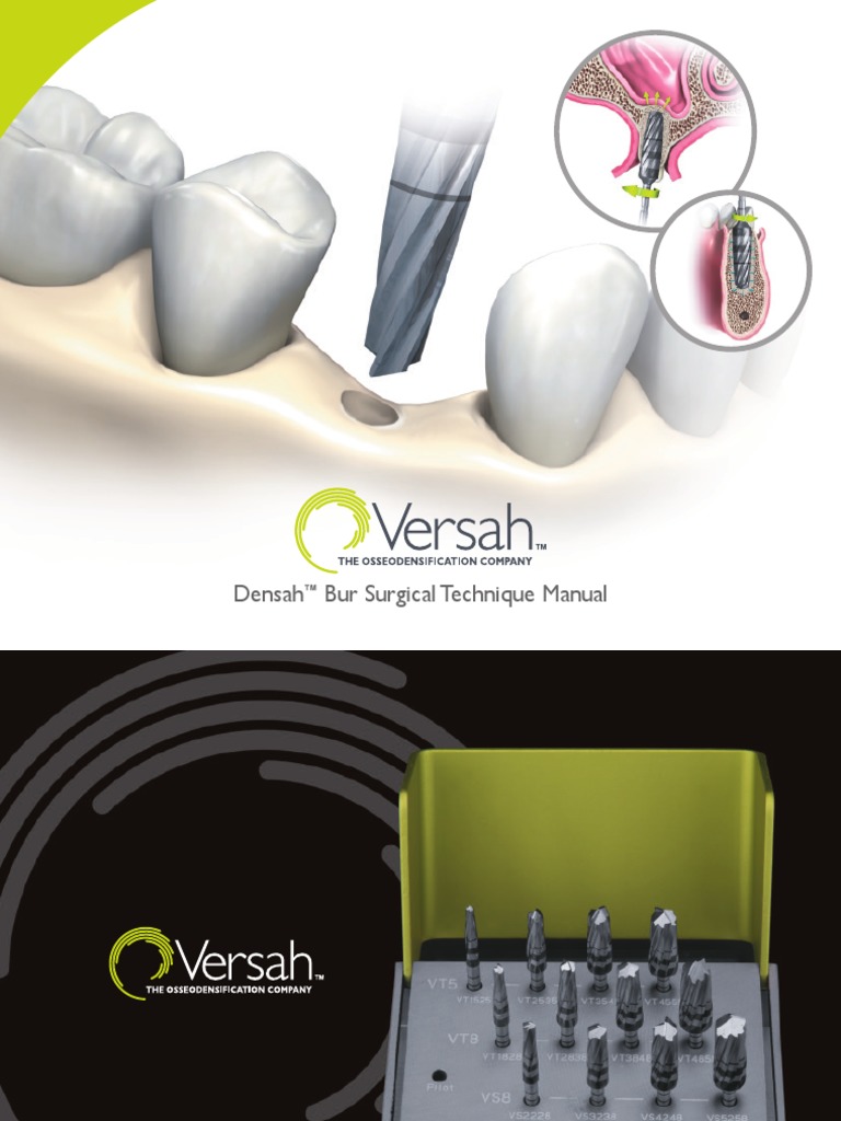 Densah Bur Surgical Technique Manual | PDF | Dental Implant | Clinical Medicine