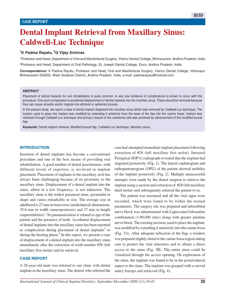 Caldwell Technique | PDF | Dental Implant | Dentistry