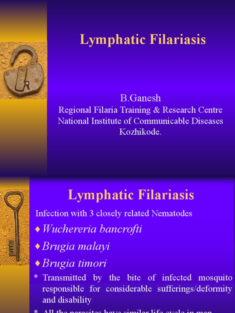 filariasis | Epidemiology | Medical