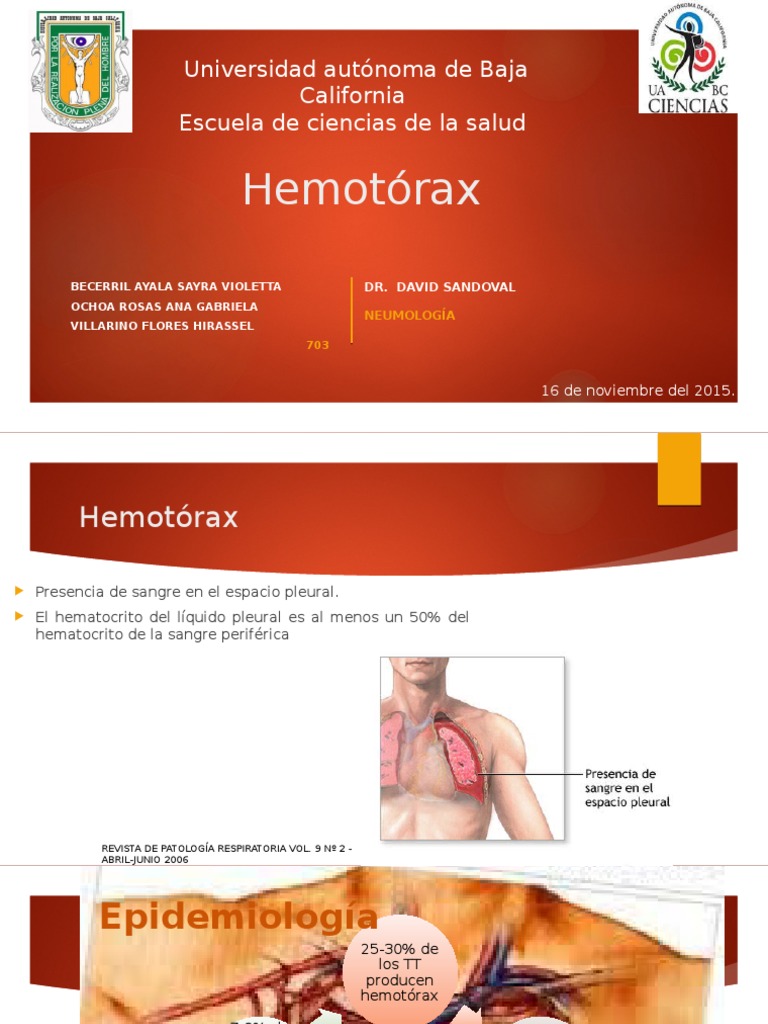 hemotorax | Lesión | Especialidades Medicas