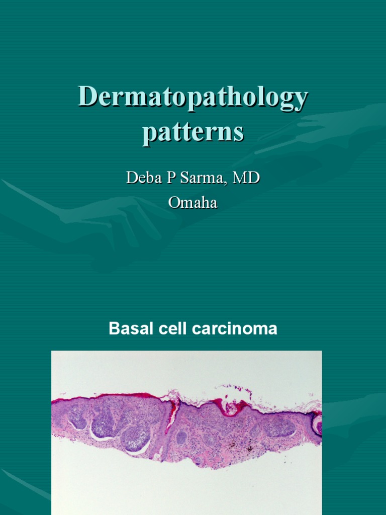 Dermatopathology Patterns-1 | PDF