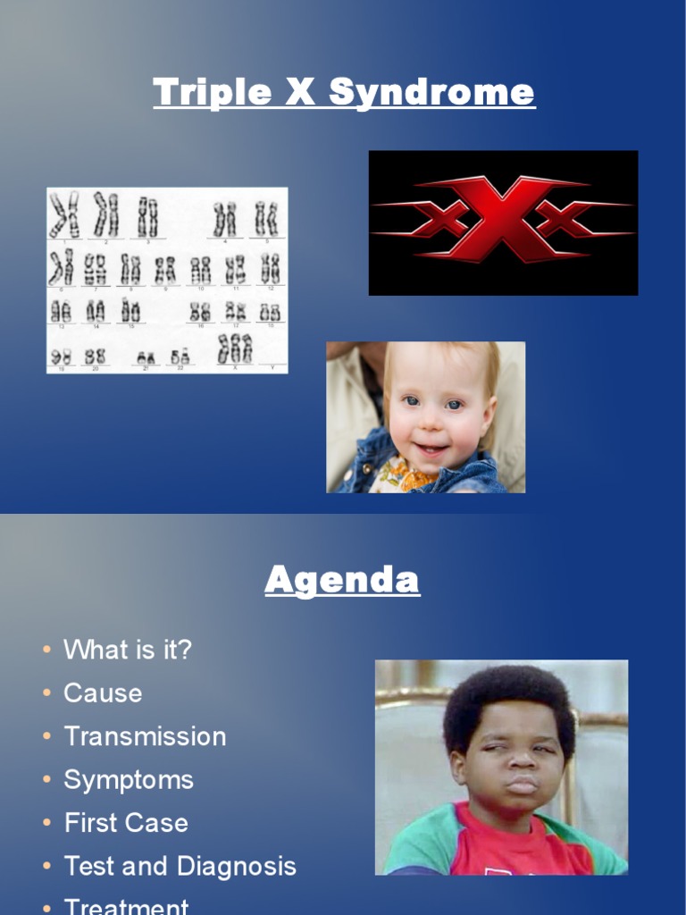 Triple X Syndrome | PDF | Biology | Genetics