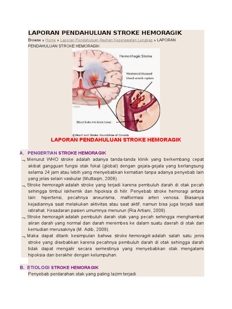 Laporan Pendahuluan Stroke Hemoragik | PDF