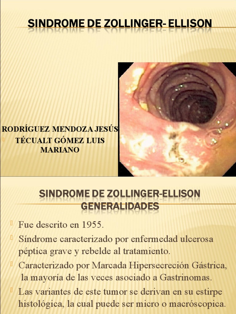 Sindrome de Zollinger-ellison