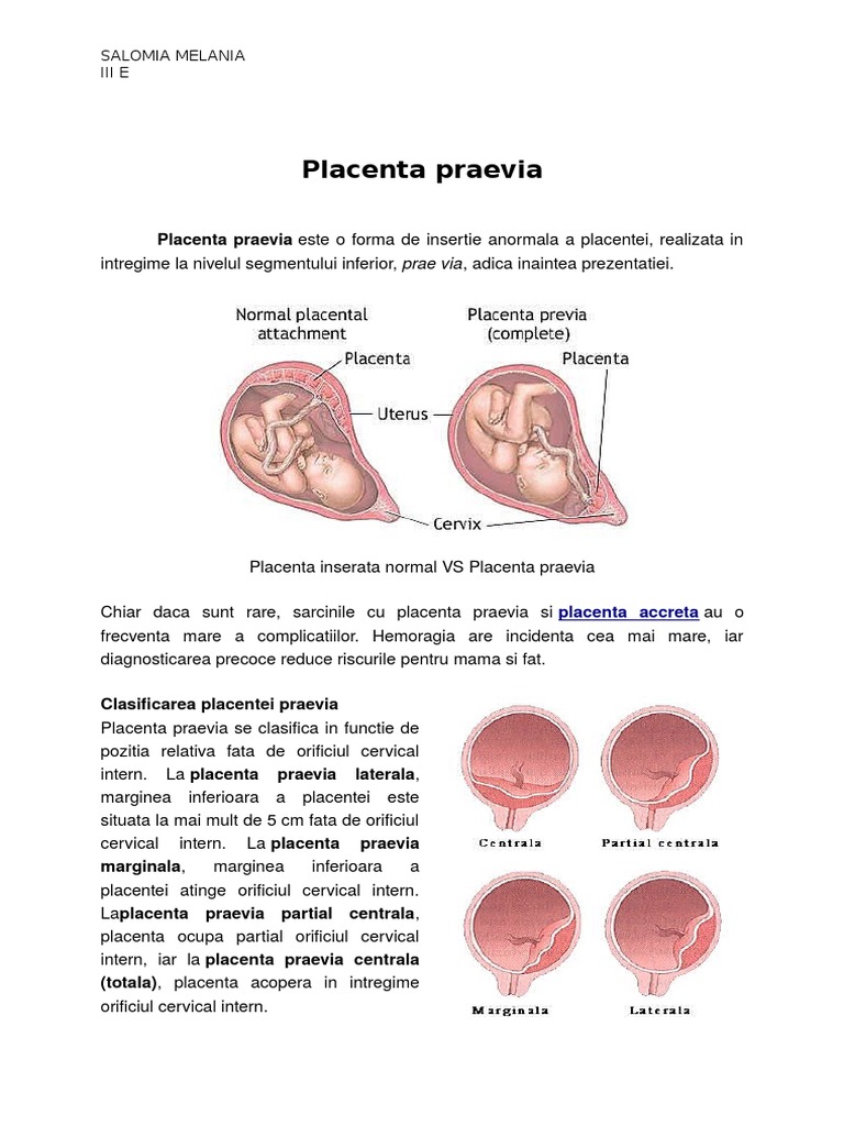 Placenta Praevia | PDF