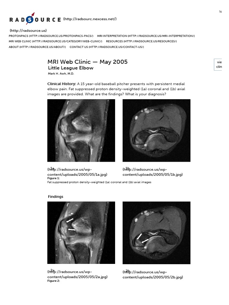 Little League Elbow - Radsource | Elbow | Musculoskeletal System