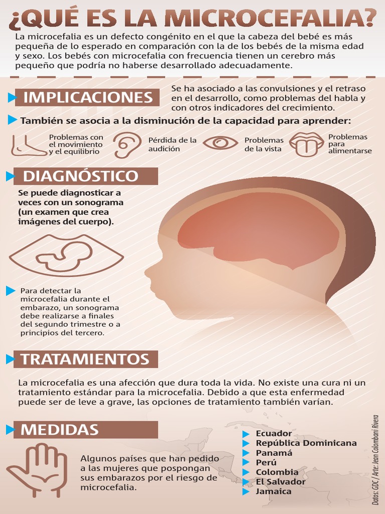 Microcefalia