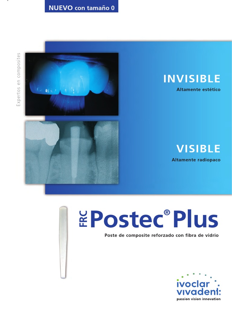 FRC Postec Plus | PDF | Compuesto Dental | Aluminio