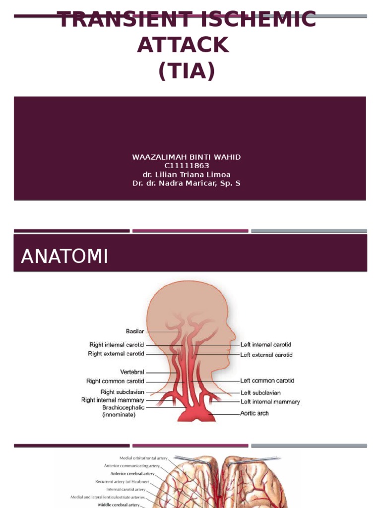 Transient Ischemic Attack