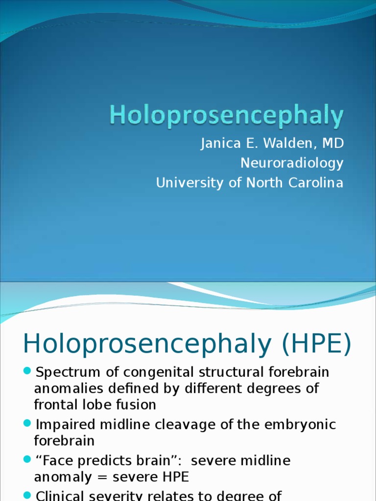 Holoprosencephaly | PDF | Thalamus | Cerebrum
