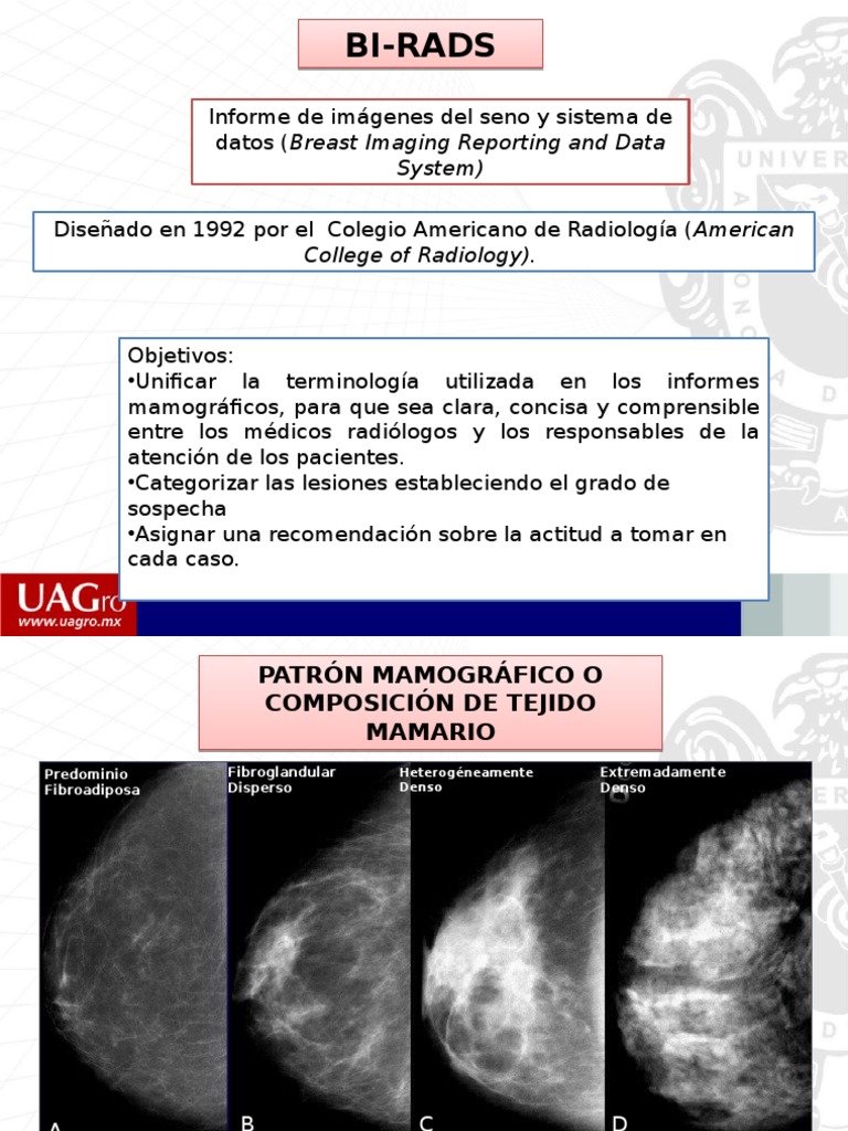Clasificación BI-RADS en Mamografía | PDF | Cáncer de mama | Ciencias ...