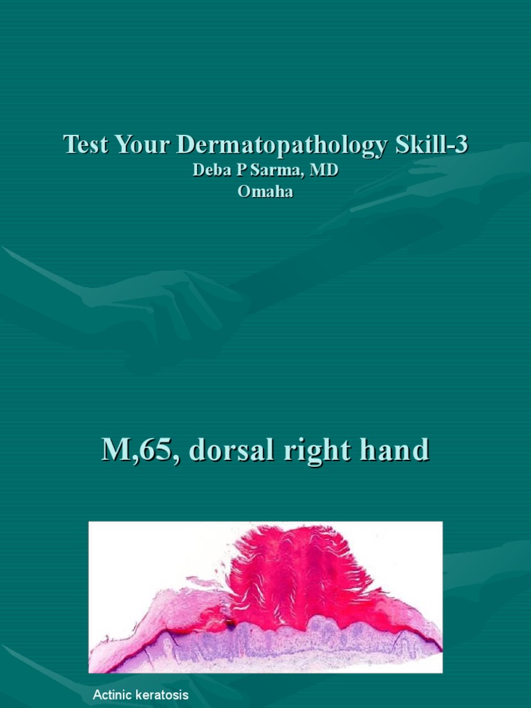 Test Your Dermatopathology Skill - Test 3 | PDF