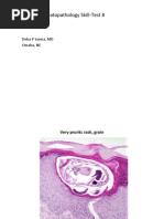 Severity Scoring of Atopic Dermatitis Index SCORAD PDF | PDF ...