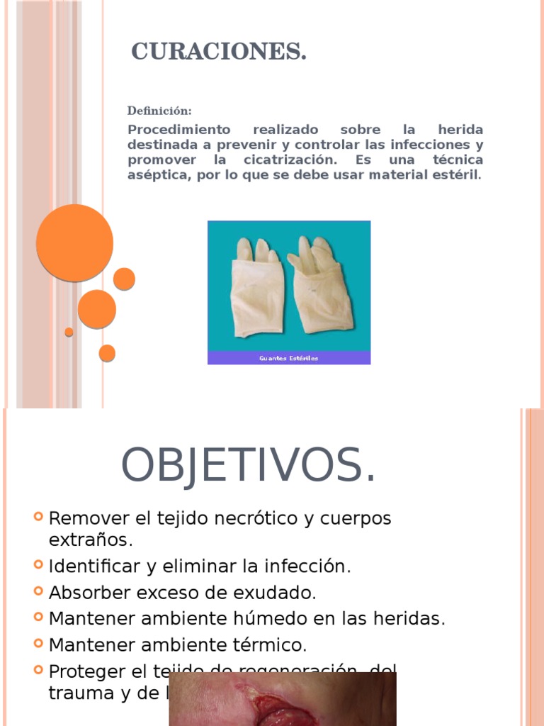 Curaciones: Técnicas y Objetivos Esenciales | PDF