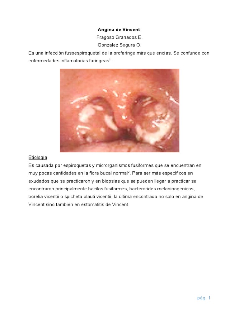 Angina de Vincent | PDF | Medicina CLINICA | Enfermedades y trastornos