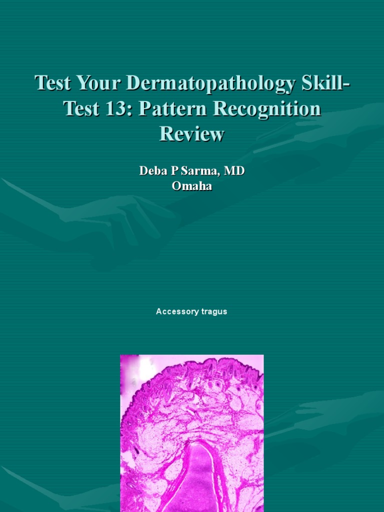Dermatopathology Pattern Quiz | PDF