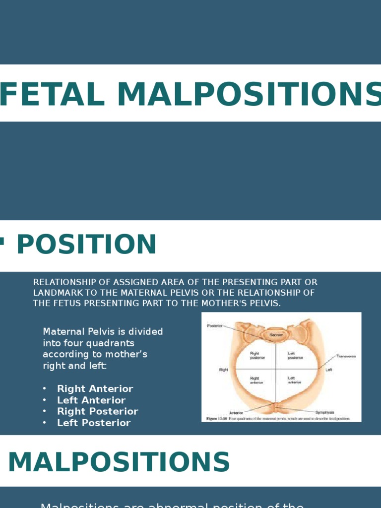 FETAL MALPOSITION | Fetus | Childbirth