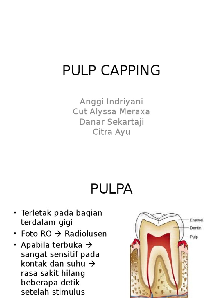 Pulp Capping | PDF | Sains & Matematika