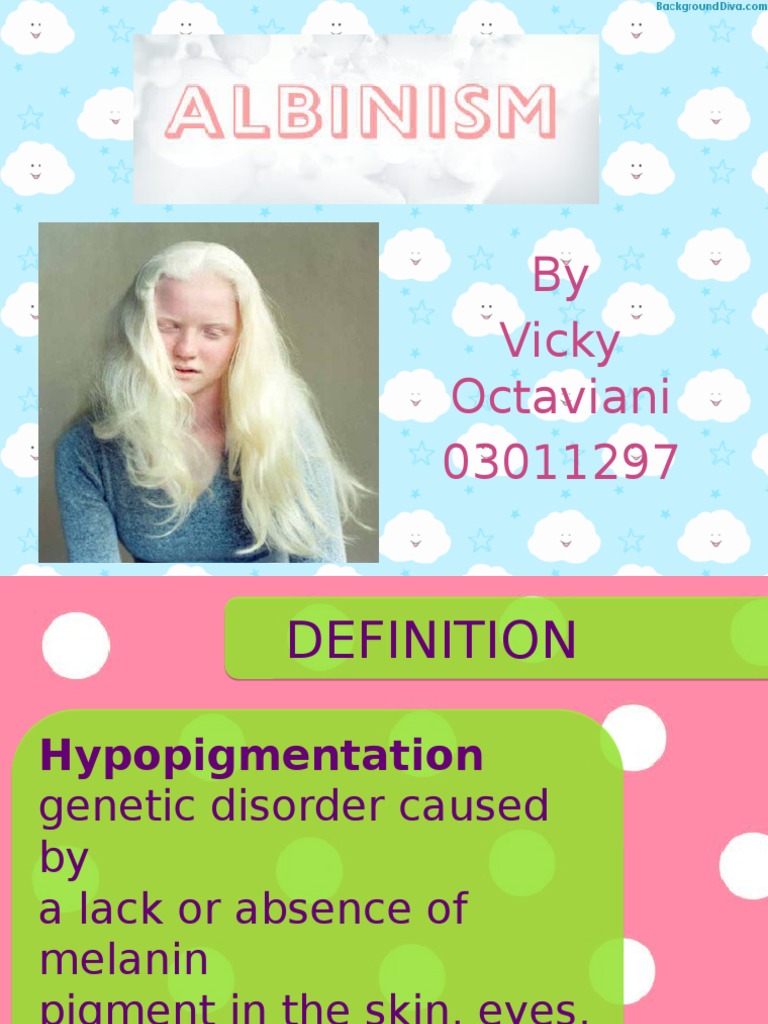 Albinism: Causes, Symptoms, and Diagnosis | PDF