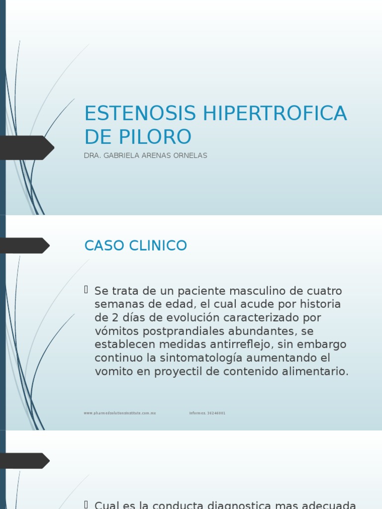 estenosis piloro | Estómago | Abdomen
