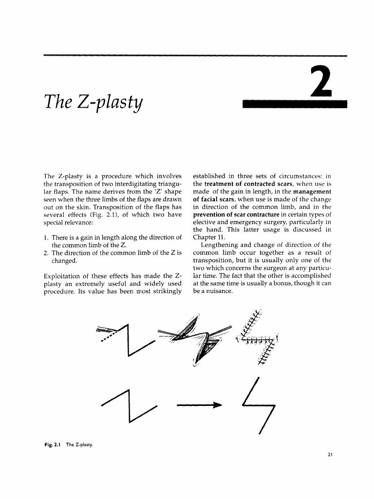 Chapter 2 The Z Plasty 2000 Fundamental Techniques of Plastic Surgery Tenth Edition | PDF ...