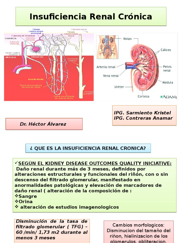 Insuficiencia Renal Cronica 1 | PDF | Enfermedad renal crónica | Riñón Insuficiencia Renal Cronica 1 | PDF | Enfermedad renal crónica | Riñón