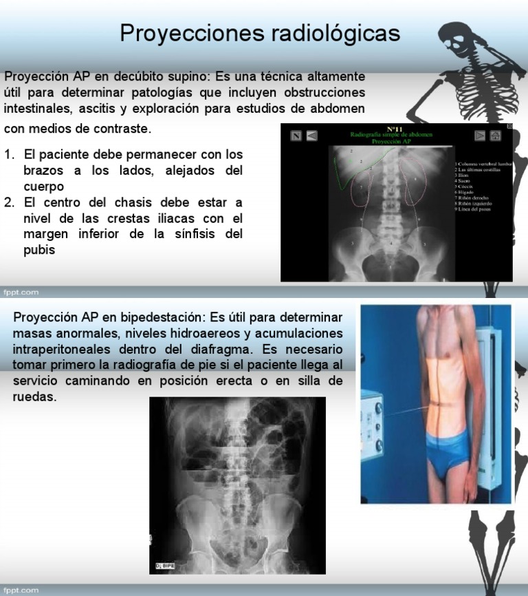 Proyecciones radiológicas