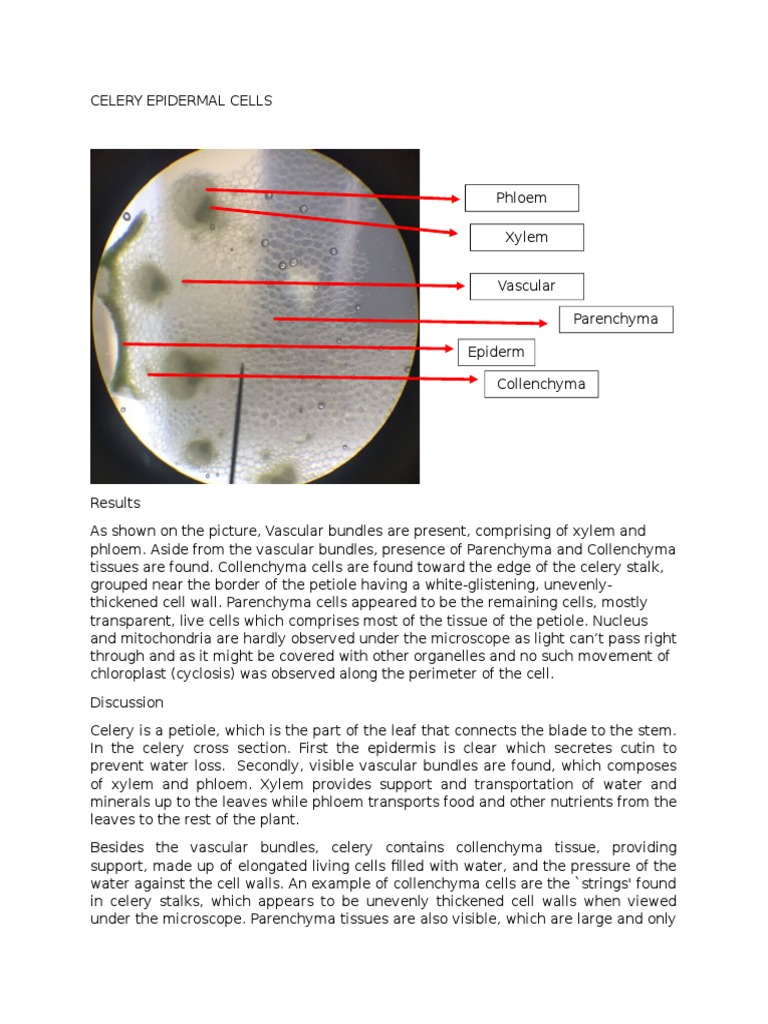 Xylem And Phloem Diagram Of Celery