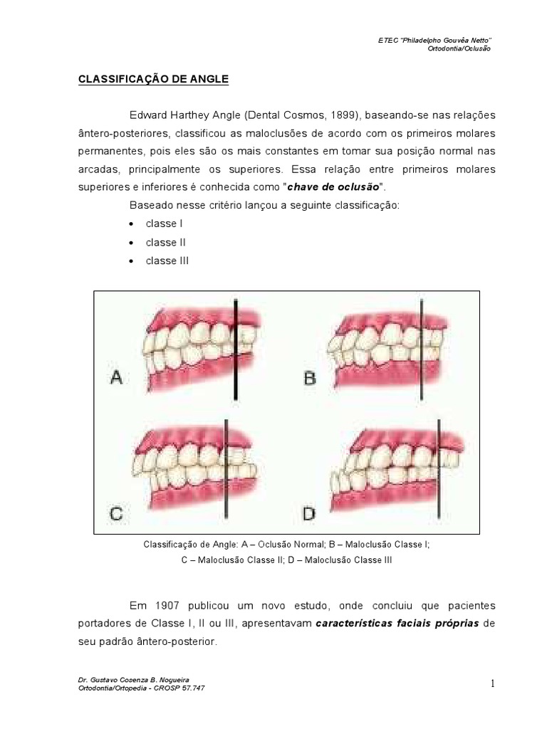 Classificao de Angle | PDF | Dente | Ortodontia