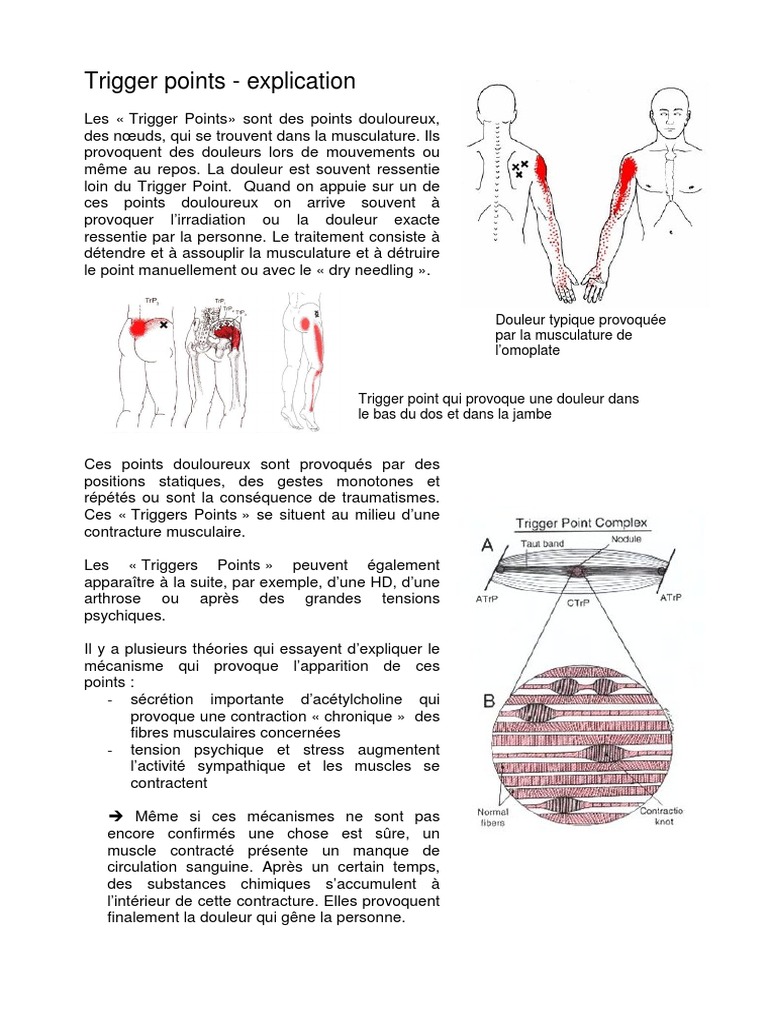 Comprendre les Trigger Points Musculaires | PDF
