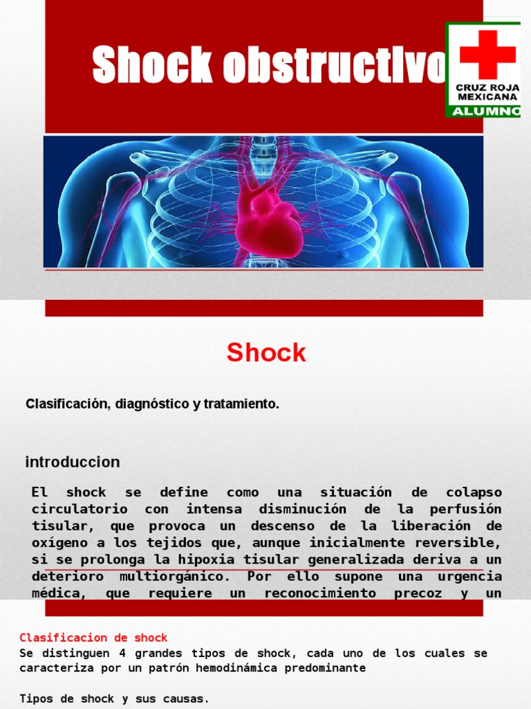 Shock Obstructivo | Choque (circulatorio) | Corazón