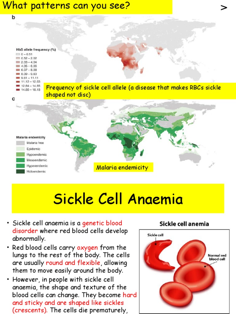 Mutation and Sickle Cell | PDF | Sickle Cell Disease | Mutation