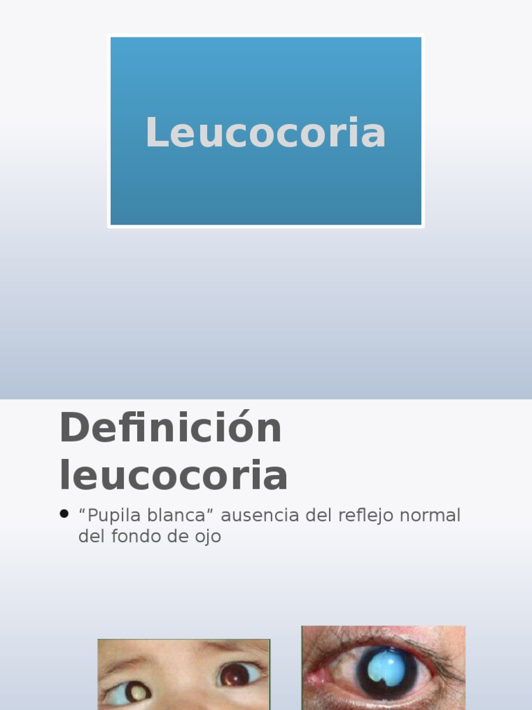 Leucocoria: Causas y Diagnóstico Infantil | PDF | Ojo humano | Catarata