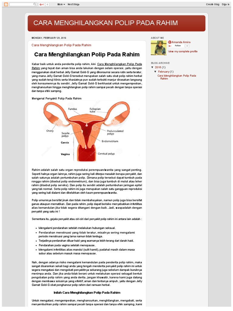Cara Menghilangkan Polip Pada Rahim | PDF