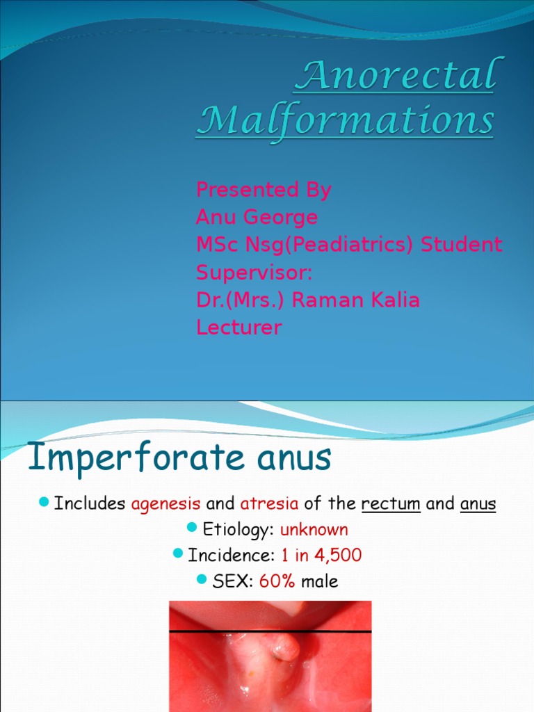 Anorectal Malformation | PDF | Pelvis | Diseases And Disorders