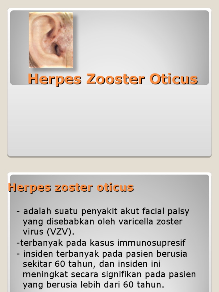 Herpes Zooster Oticus | PDF