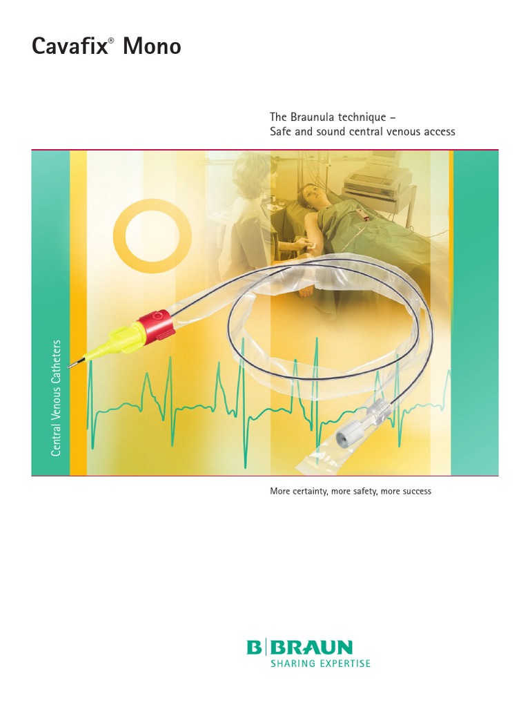 Cavafix Mono 04.08 | PDF | Catheter | Cardiovascular System