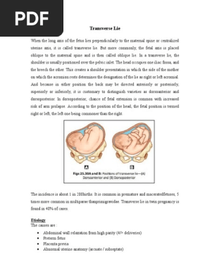 Oblique Lie Presentation
