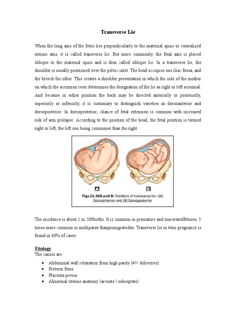 Transverse Lie | PDF | Childbirth | Pelvis