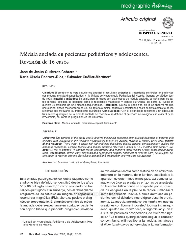 Medula Anclada | PDF | Médula espinal | Escoliosis
