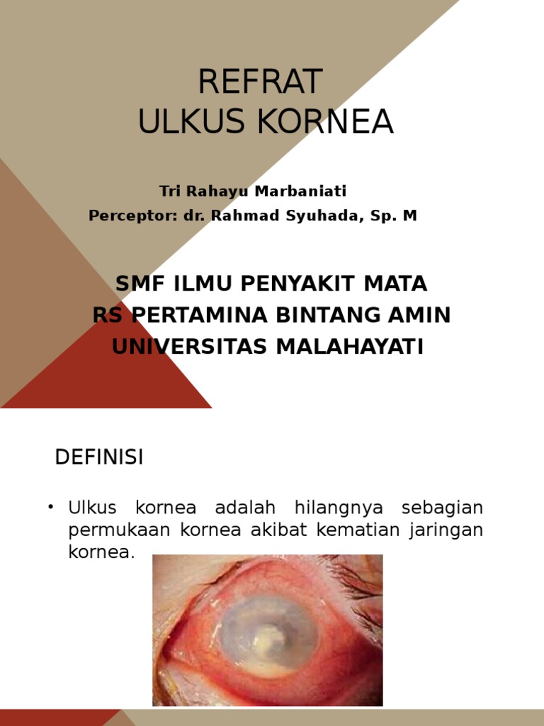 Ulkus Kornea | PDF