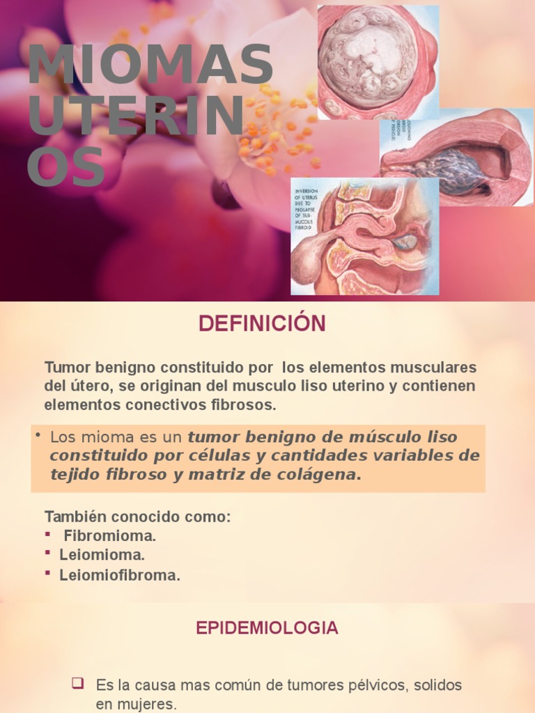 MIOMAS UTERINOS | Útero | El embarazo