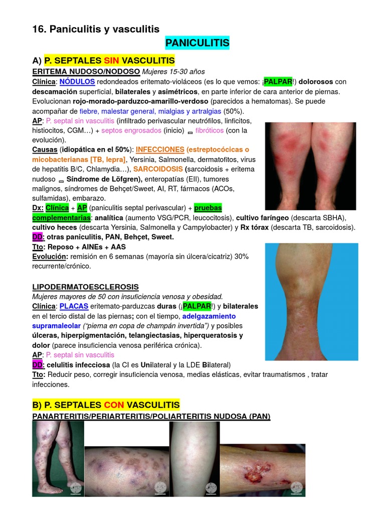 Paniculitis y Vasculitis | PDF | Especialidades Medicas | Medicina CLINICA