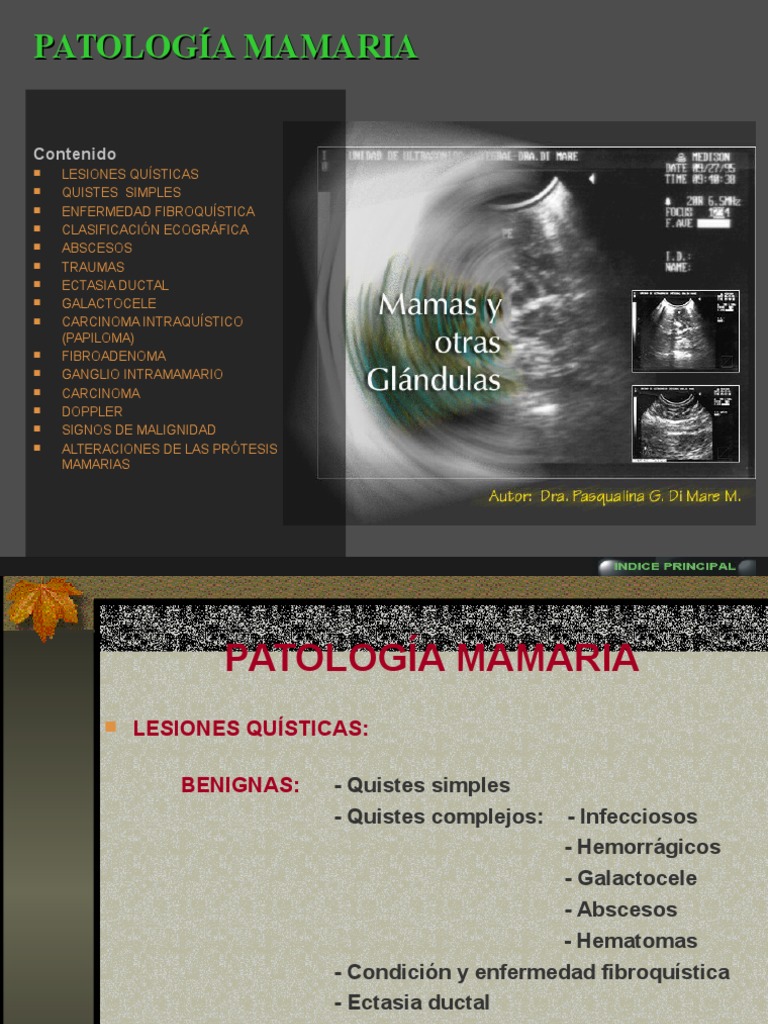 ECOGRAFÌA DE Mama Patológica | Cáncer de mama | Ultrasonido médico