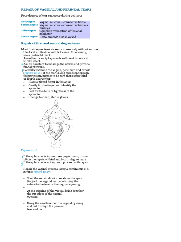 Repair Vaginal & Perineal Tears | PDF | Rectum | Vagina