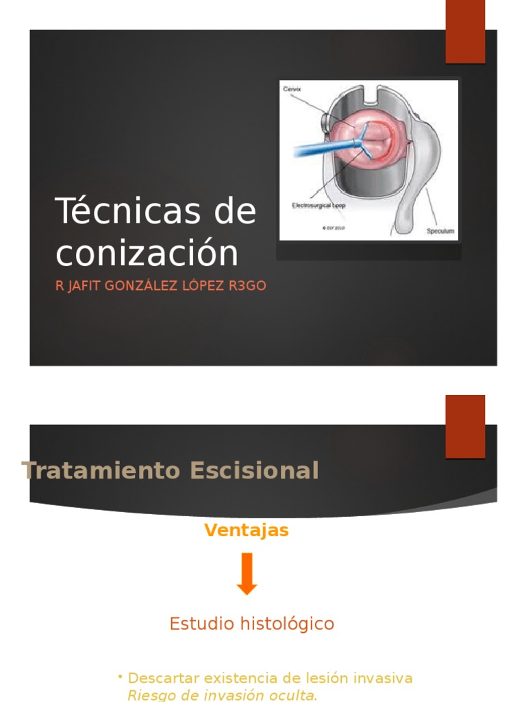 Tecnicas de Conizacion | Especialidades Medicas | Medicina CLINICA