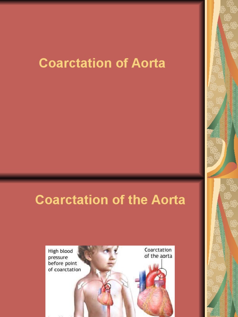 Coarctation of The Aorta | PDF | Aorta | Blood Pressure